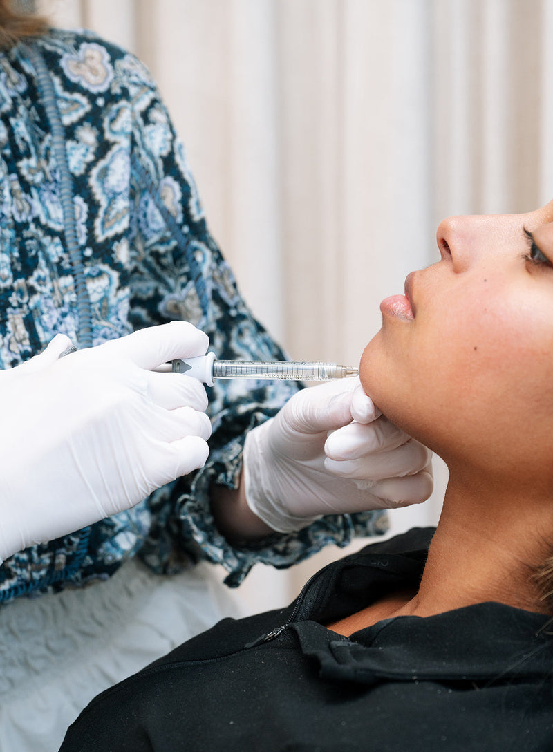 Chin Filler: Before and After | Skin Pharm