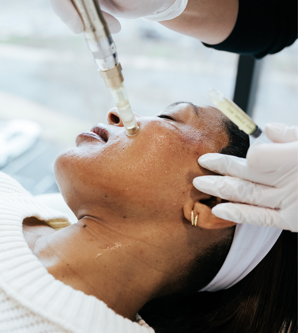 Treatment Packages | Skin Pharm