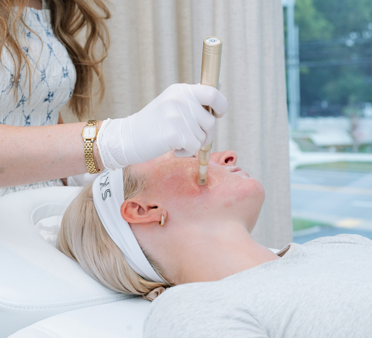 Microneedling | Skin Pharm