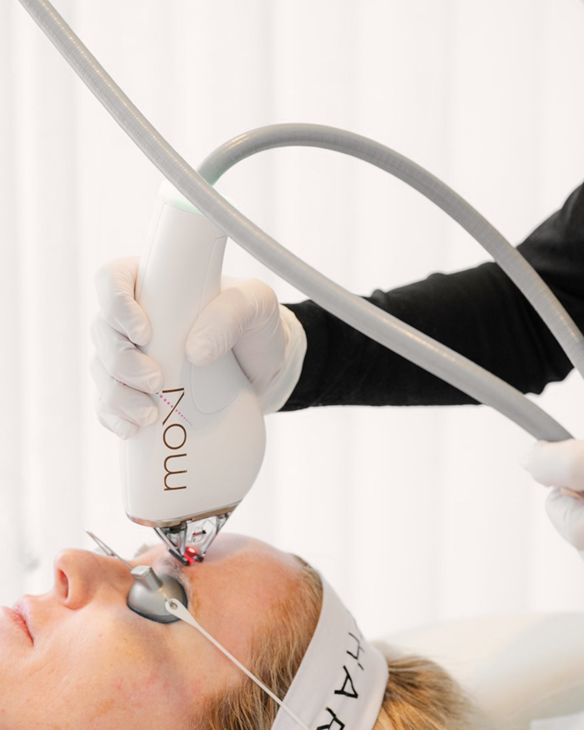 Moxi Laser | Skin Pharm